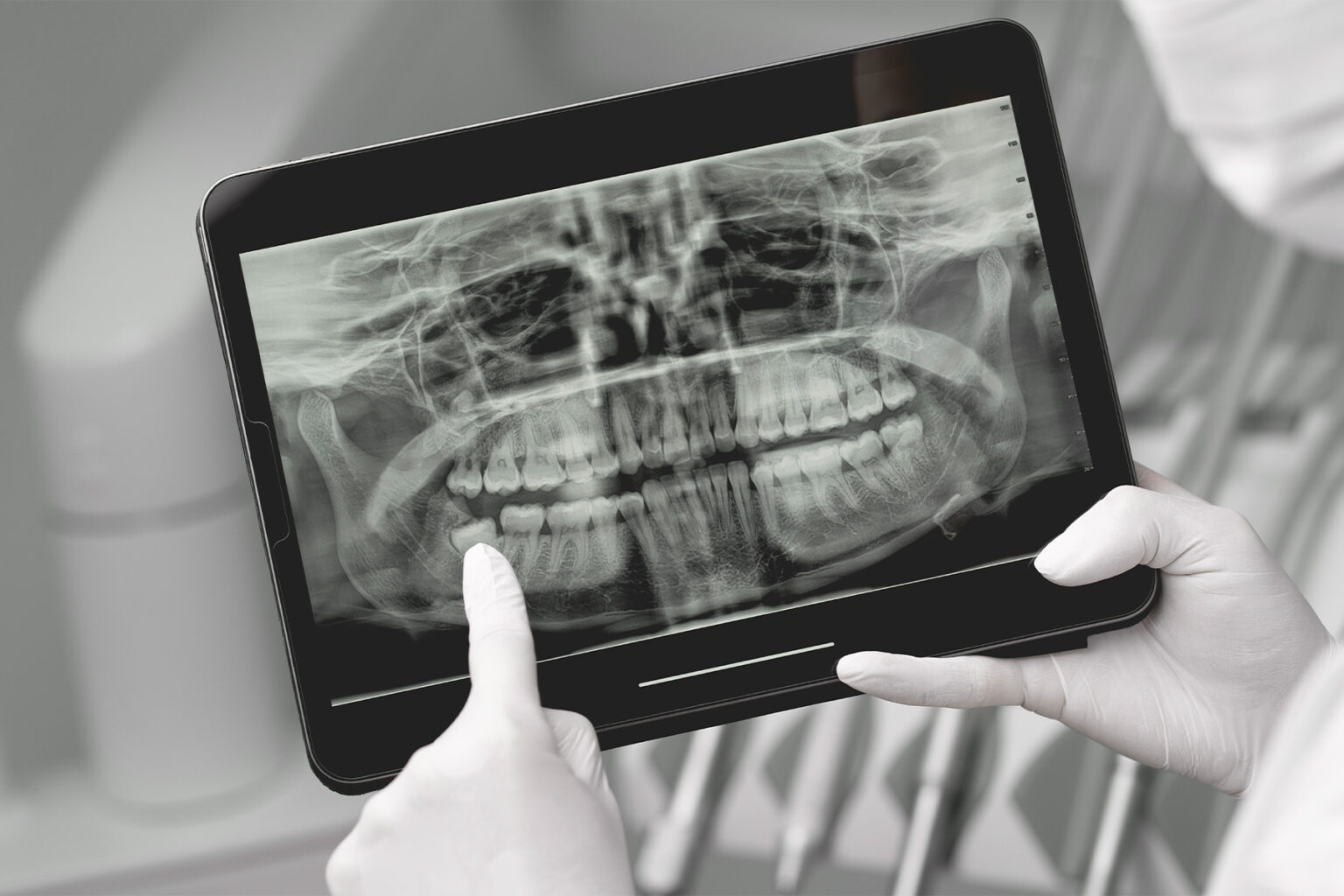 Radioprotection dentaire : obligations, bonnes pratiques et conformité - OCRP Expertise